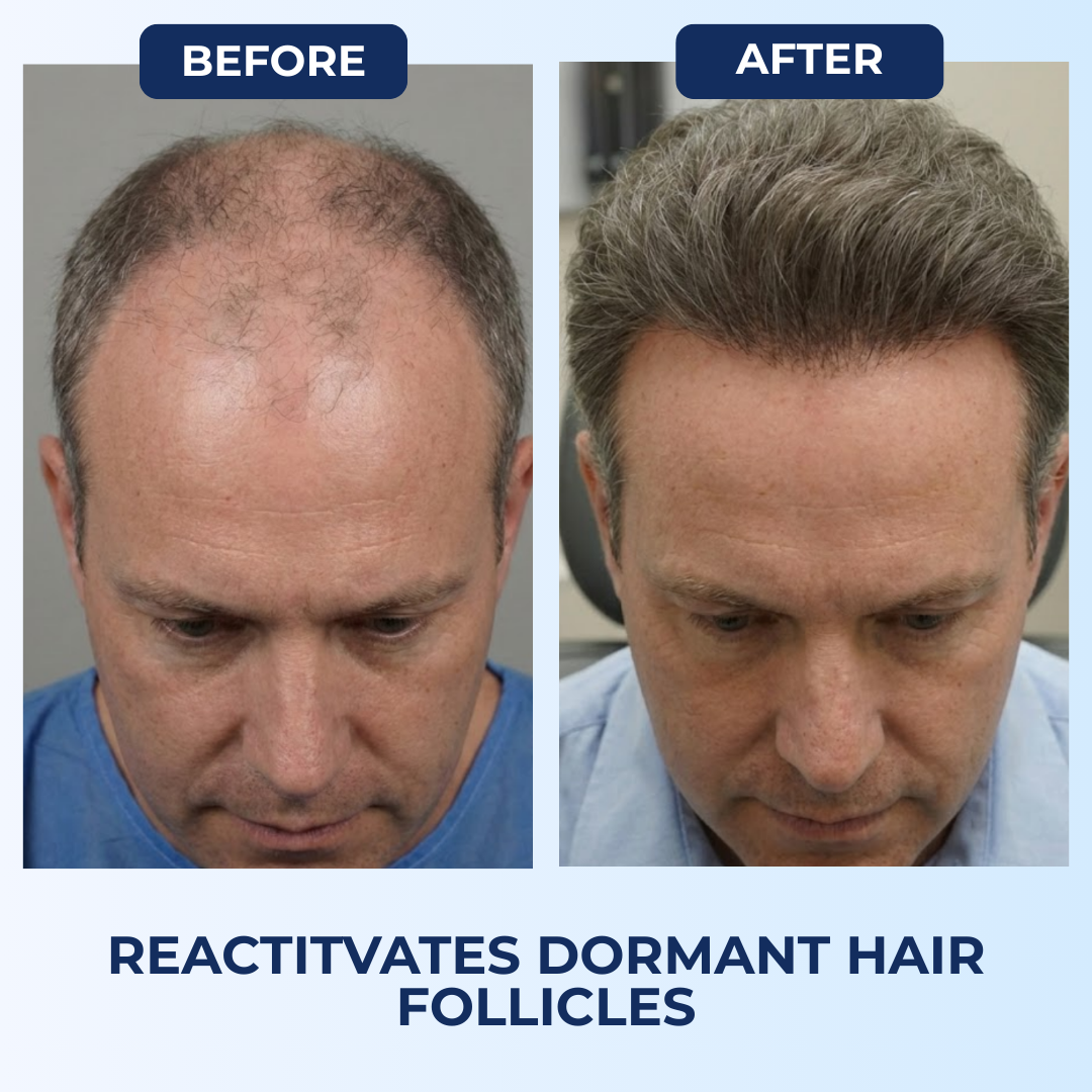 Regenics™ Peptide Infusion System